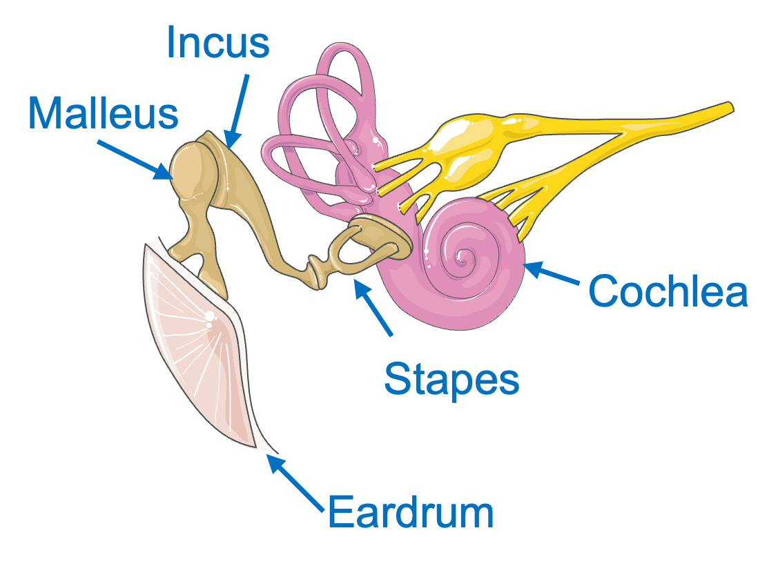 Otosclerosis – Adrien A. Eshraghi, MD, MSc, FACS